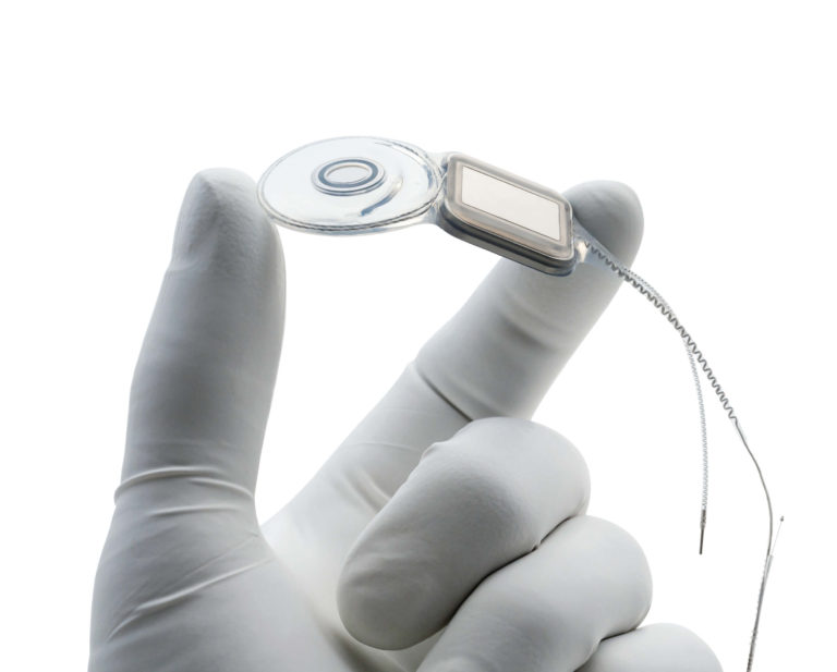 ¿Cómo es una cirugía de implante coclear?