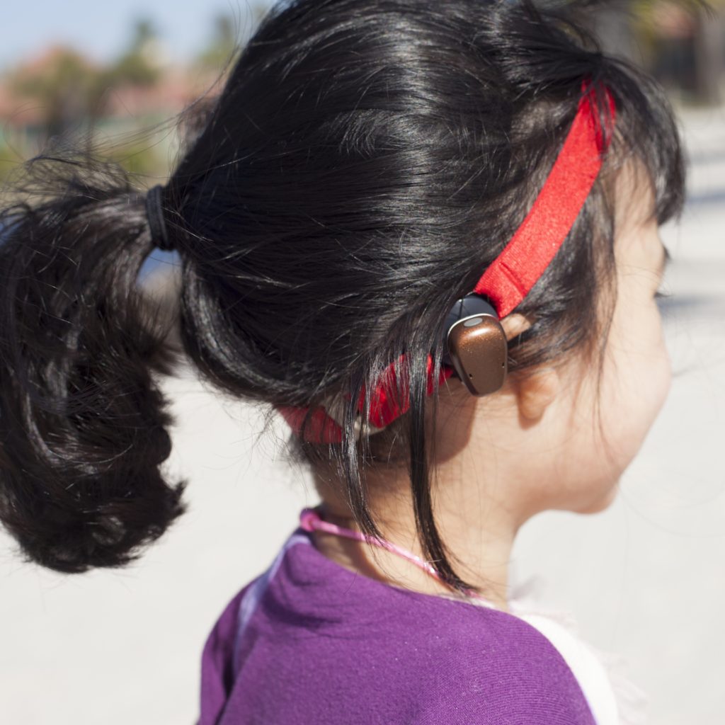 Ventajas de los Dispositivos SoundArc™ y SoftBand de Baha®