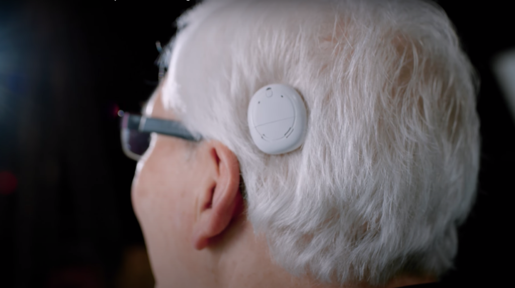 Anécdotas de adultos expertos con implantes cocleares