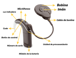 Así es la tecnología integrada a un implante coclear