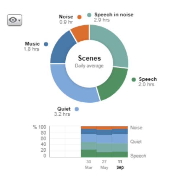 Smartsound IQ e implante coclear