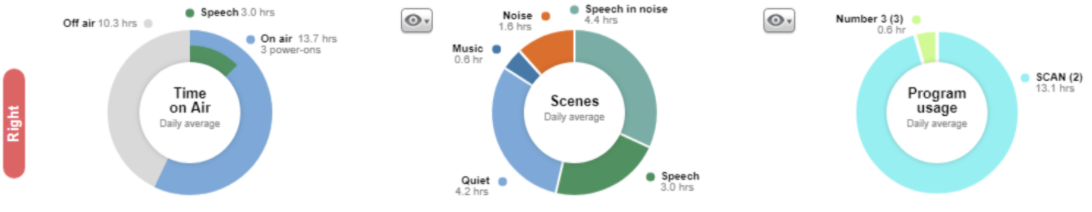Smartsound IQ e implante coclear