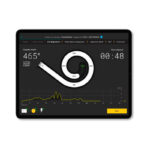 ¿Ya conoce la herramienta intraquirúrgica Nucleus® SmartNav?