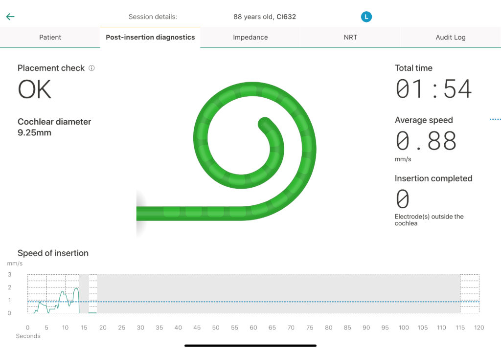 Caso de Estudio: Corrección intraoperatoria de una colocación de CI632 ...