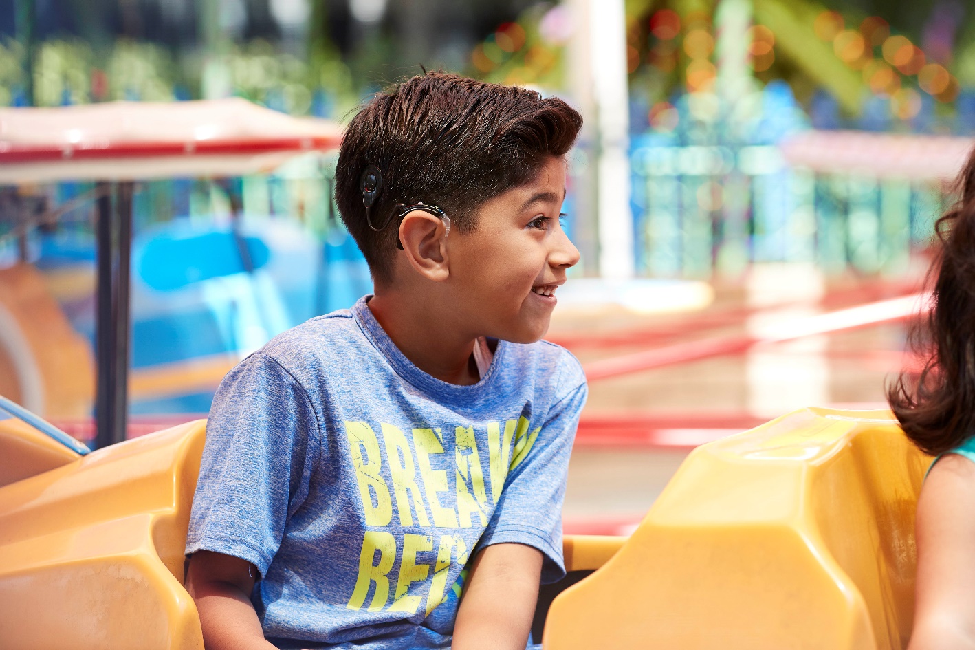 ¿Qué es la proximidad modiolar y cuáles son sus beneficios?